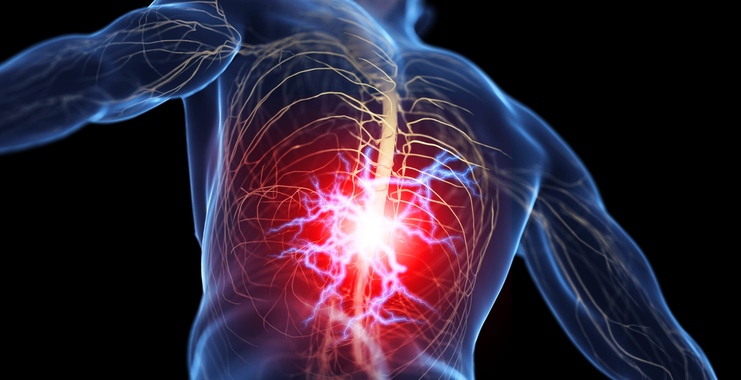 SPINAL ARACHNOIDITIS & SSD BENEFITS - Cannon Disability Law SPINAL ARACHNOIDITIS & SSD BENEFITS - Cannon Disability Law